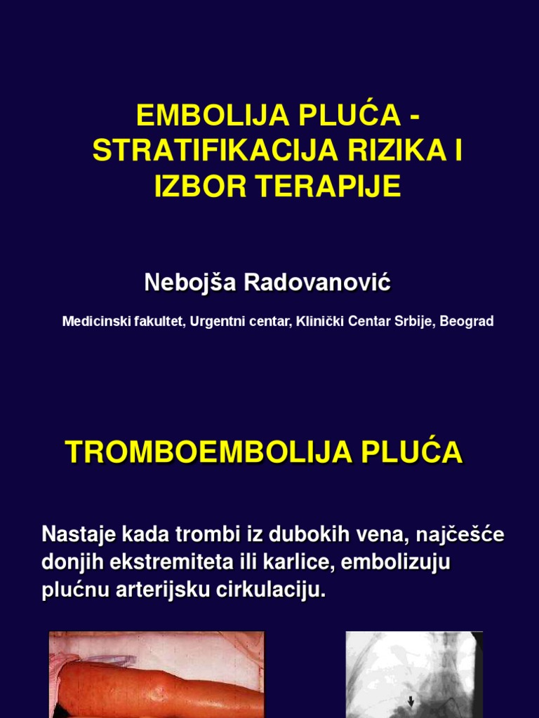 5 - Embolija Pluca | PDF