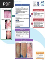 Dyshidrotic Eczema (Pompholyx, Vesicular Hand Eczema) - DermNet | PDF ...