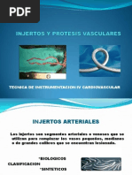 Cateter Fogarty. | PDF | Pierna humana | Medicina CLINICA