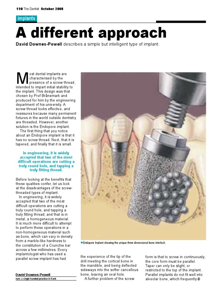 200810110-112 Innova Article | PDF | Dental Implant | Dentistry