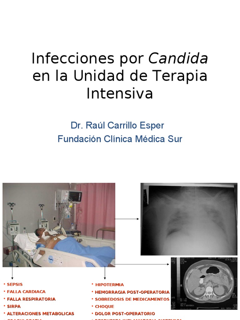 Infecciones Por Candida en La Terapia Intensiva | Septicemia | Candidiasis