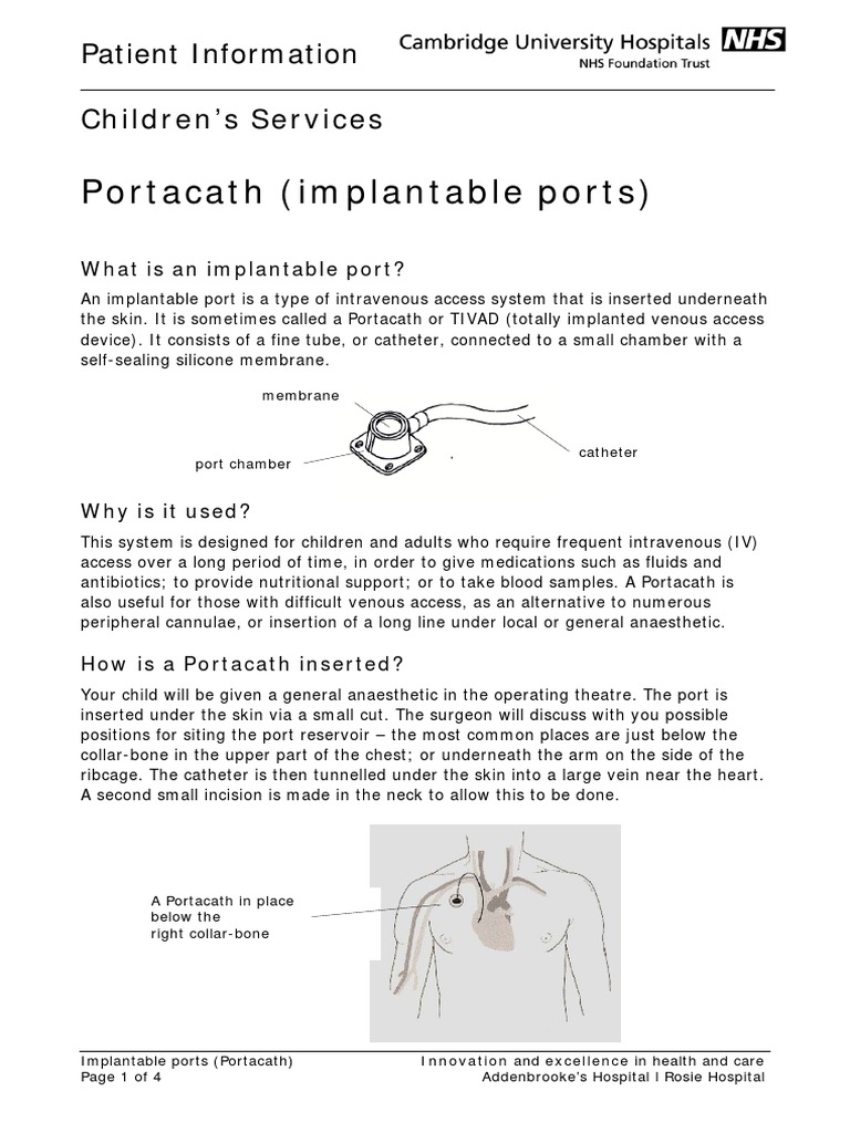PIN2428 Implantable Ports Portacath | Intravenous Therapy | Health Sciences