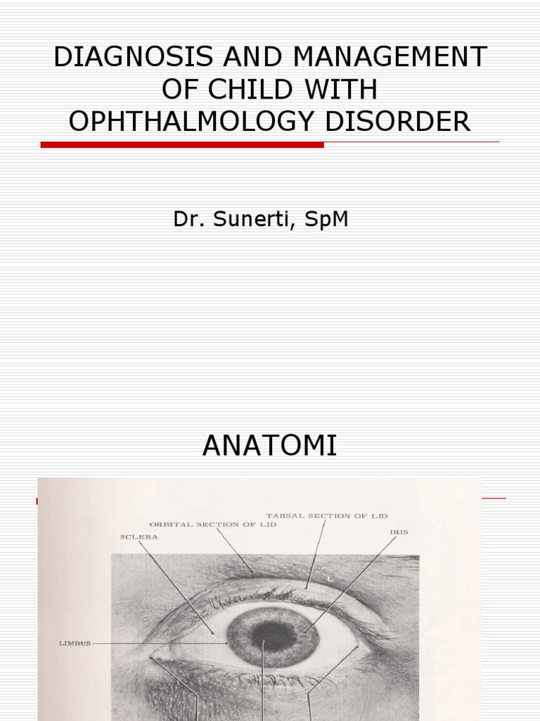 Lecture 18 Diagnosis and Management of Child With Opthalmology Disorder ...