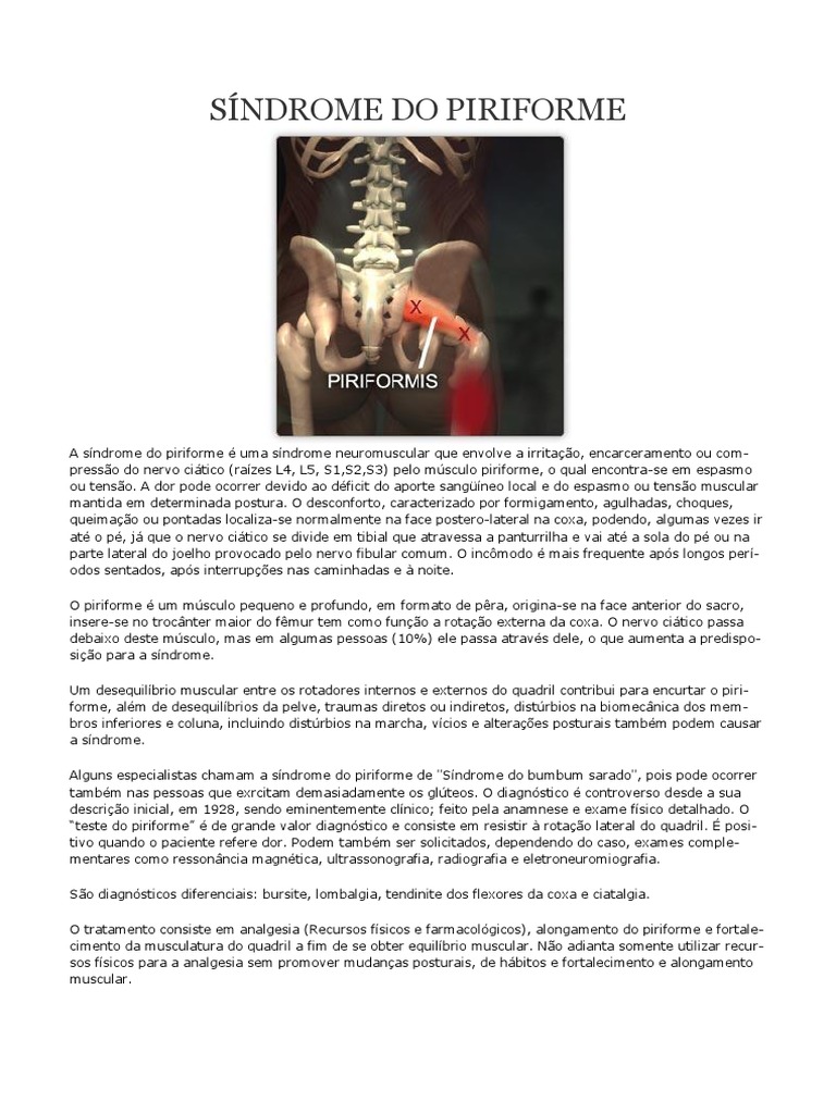 Síndrome Do Piriforme | PDF | Anatomia humana | Doenças e distúrbios