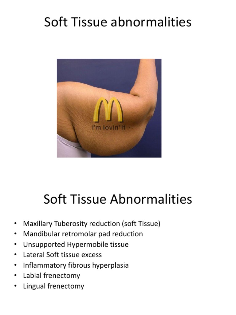 Soft Tissue Abnormalities | PDF | Dentures | Mouth