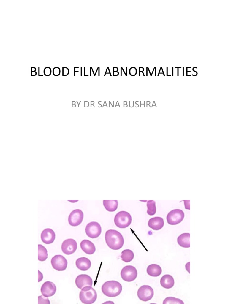 Blood Film Abnormalities | PDF | Anemia | Red Blood Cell