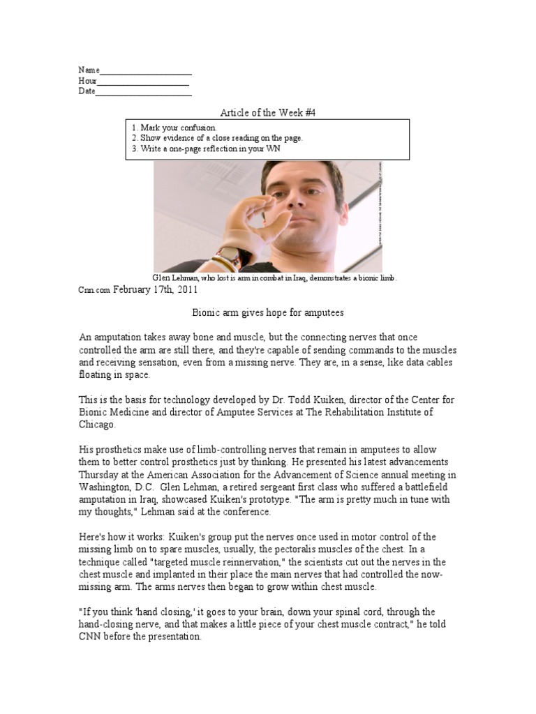 Bionic Limb | PDF | Musculoskeletal System | Animal Anatomy