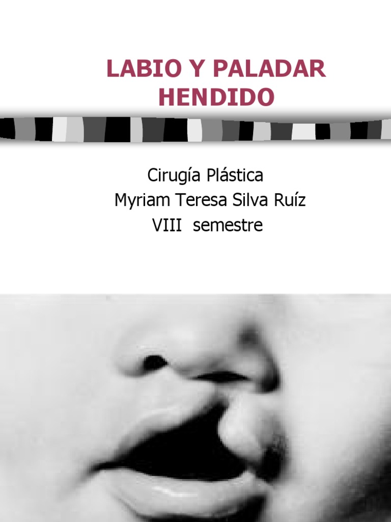 Labio y Paladar Hendido | PDF | Anatomía humana | Anatomia animal