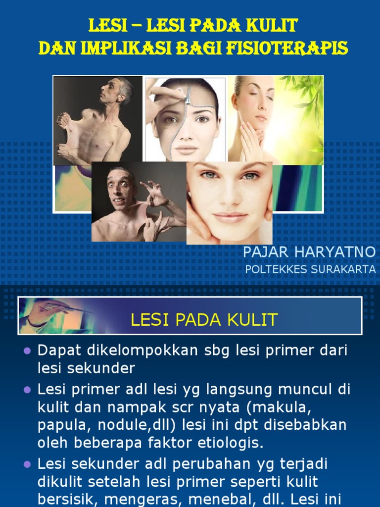 Jenis - Jenis Lesi Kulit | PDF | Sains & Matematika