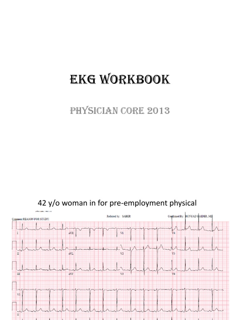 EKG Workbook | PDF | Electrocardiography | Cardiovascular Physiology