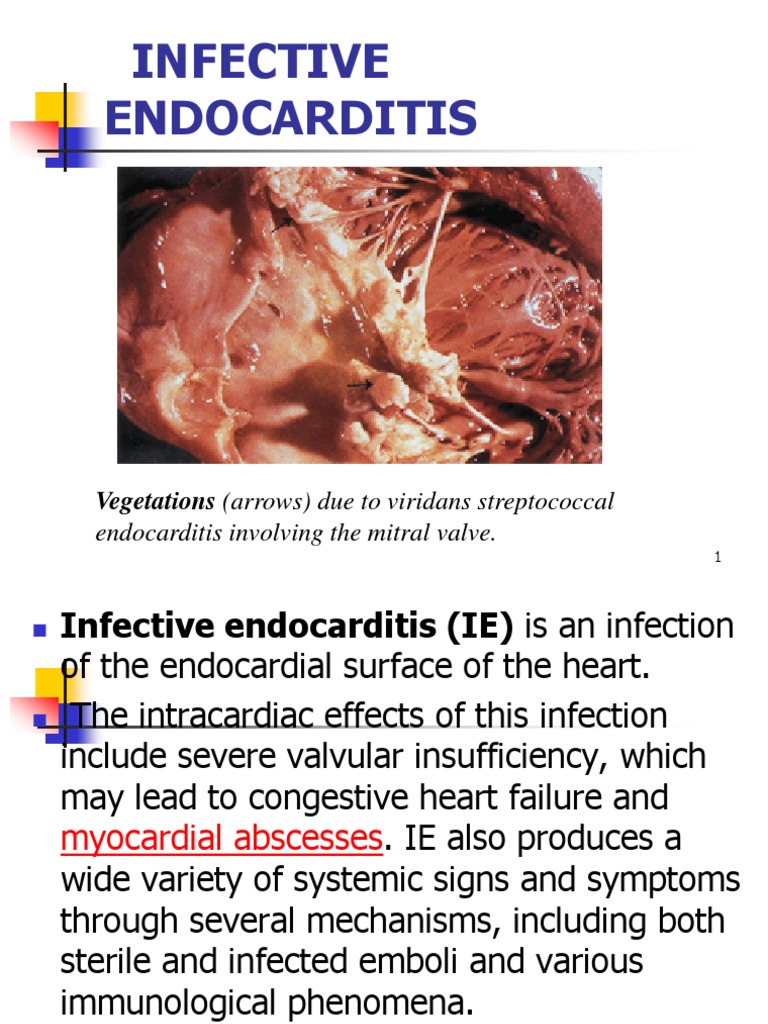 Infective Endocarditis | PDF | Microbiology | Heart