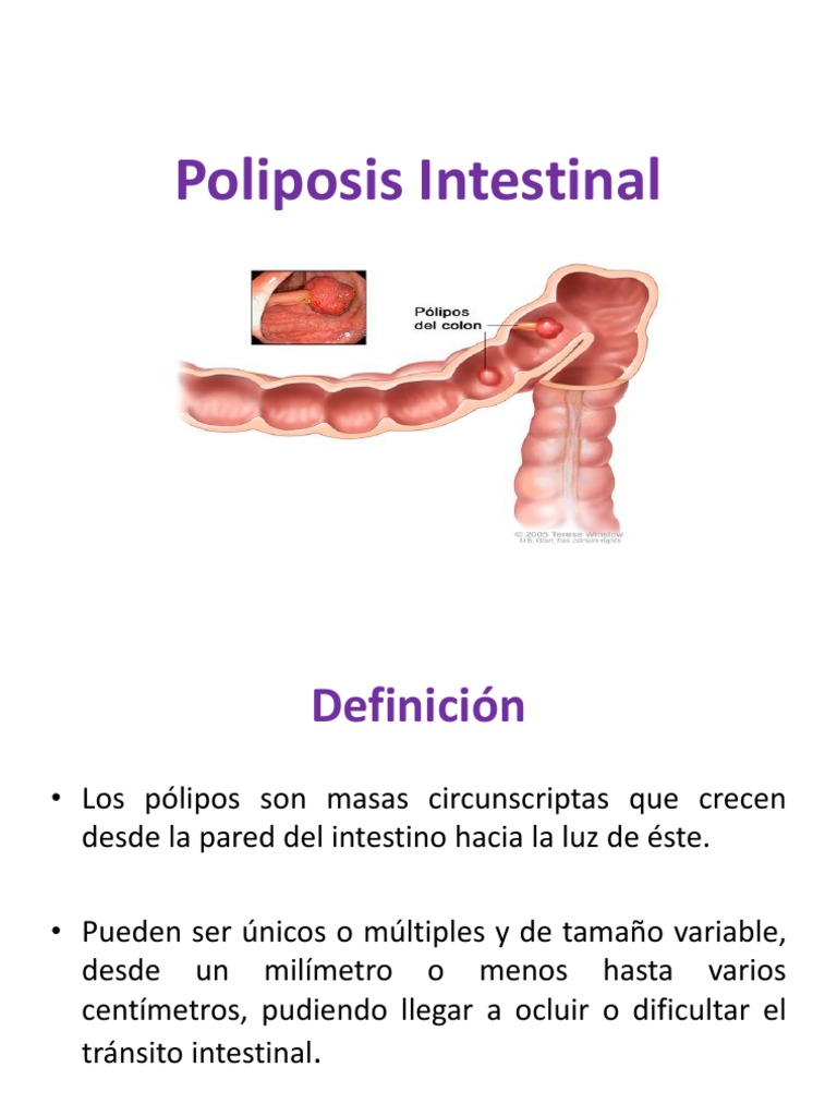 POLIPOSIS ADENOMATOSA | Cáncer colonrectal | Enfermedades digestivas
