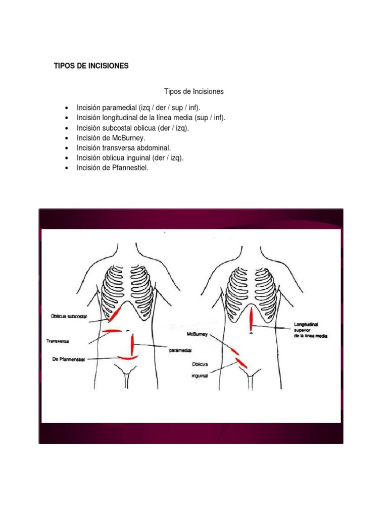 Tipos de Incisiones | PDF