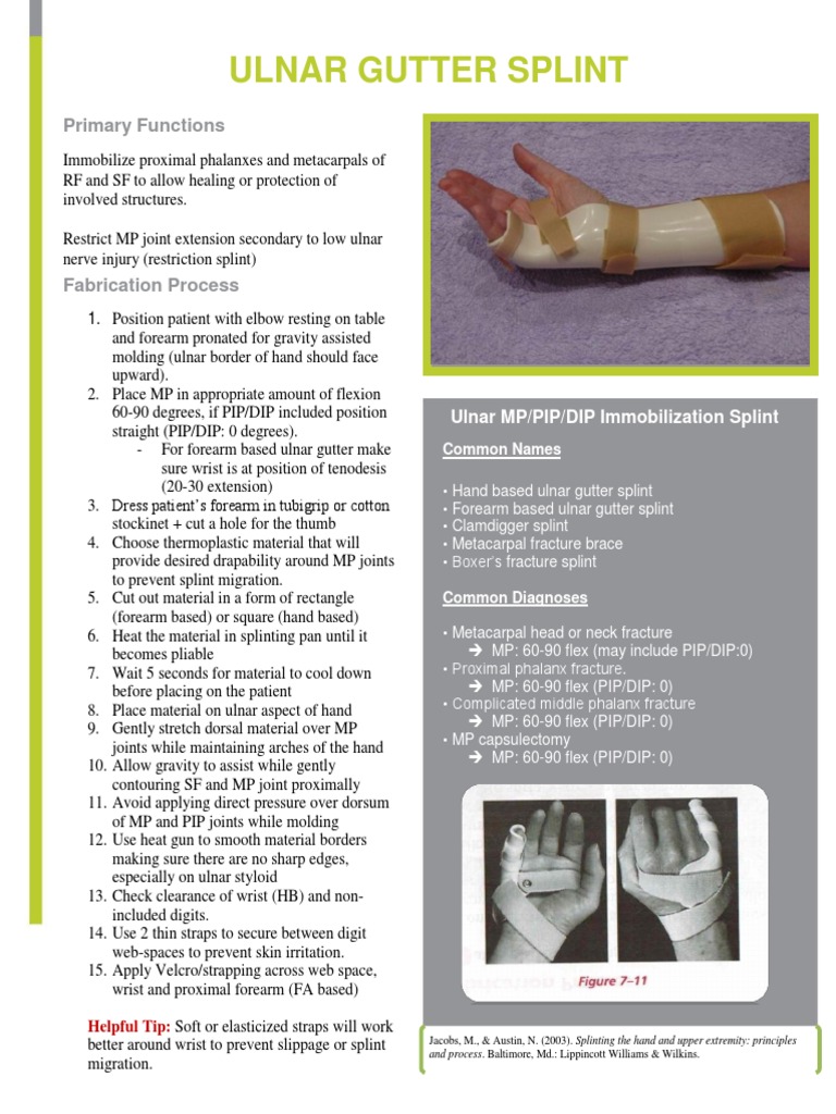 Ulnar Gutter Splint