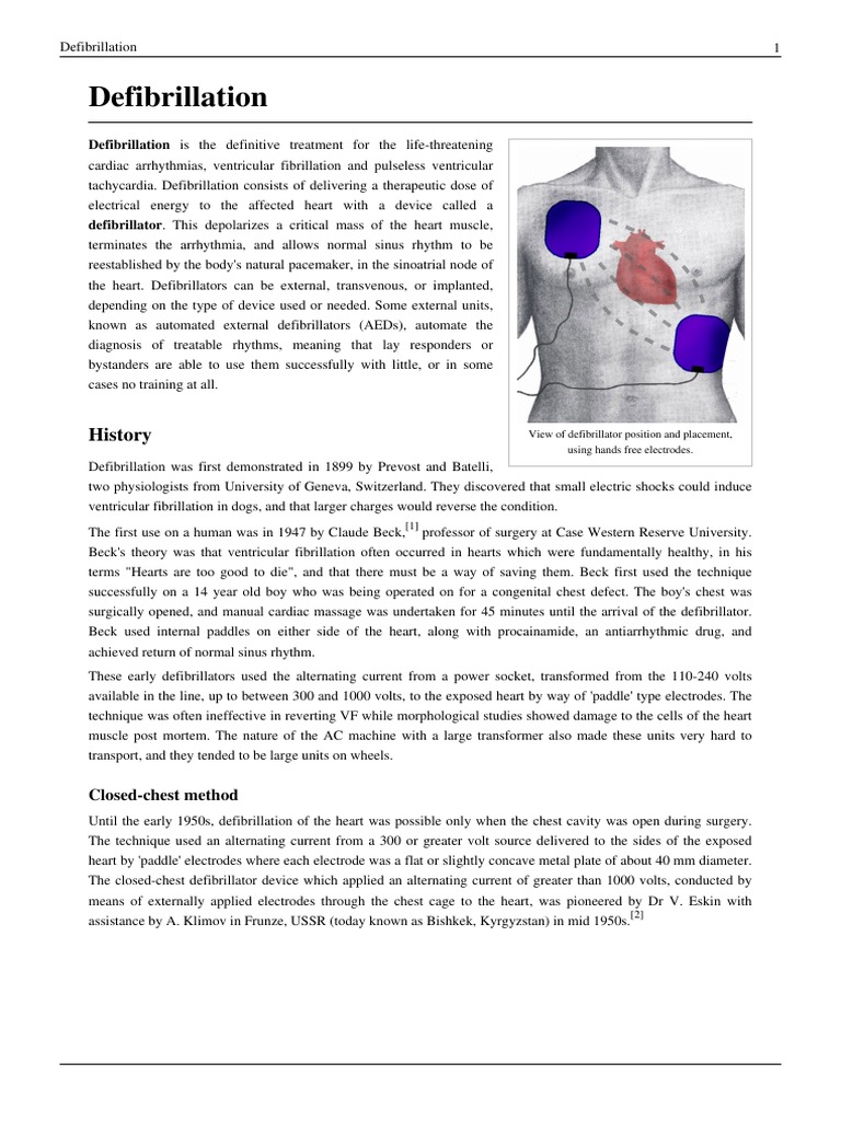 Defibrillation | PDF | Cardiovascular Physiology | Electrophysiology