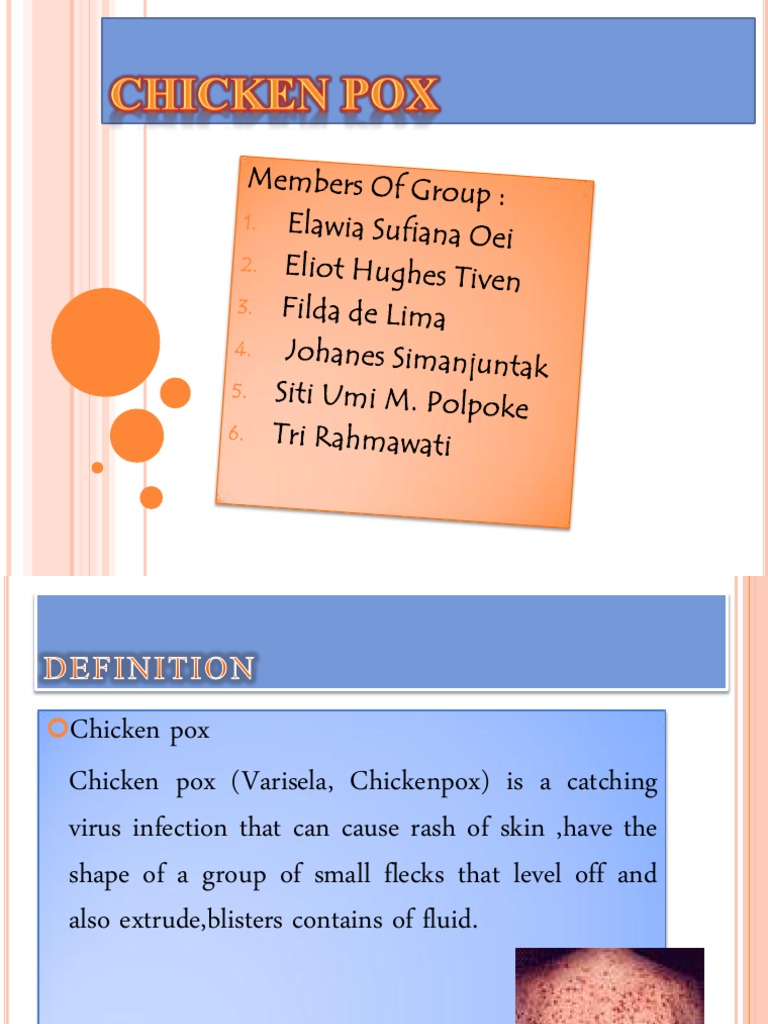 Understanding Chicken Pox: Causes and Care | PDF | Social Science ...