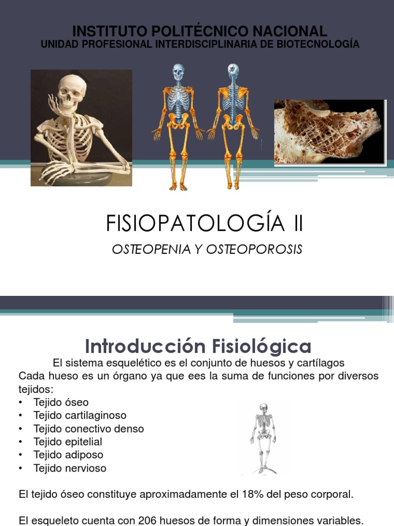 Osteopenia y Osteoporosis Final | PDF | Hueso | Osteoporosis