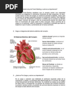 Precarga y Poscarga Cardíaca | PDF | Ventrículo (corazón) | Corazón