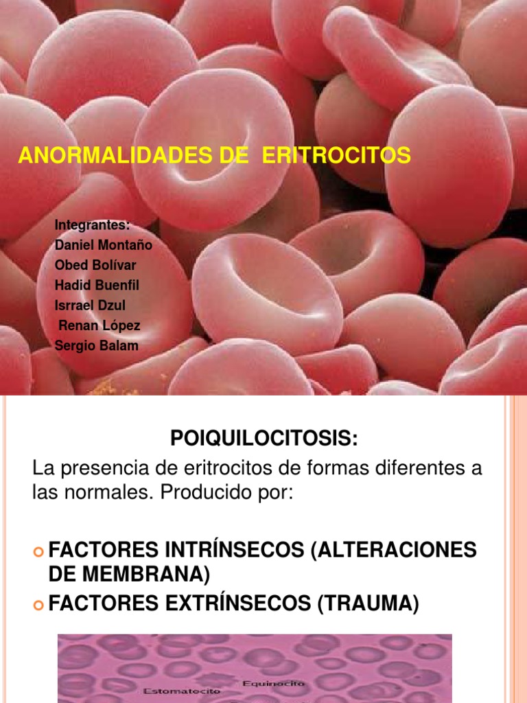 Anormalidades de Eritrocitos | PDF | Glóbulo rojo | Anemia