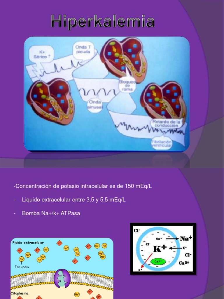 Expo de Hiperkalemia | PDF | Potasio | Dieta y nutrición