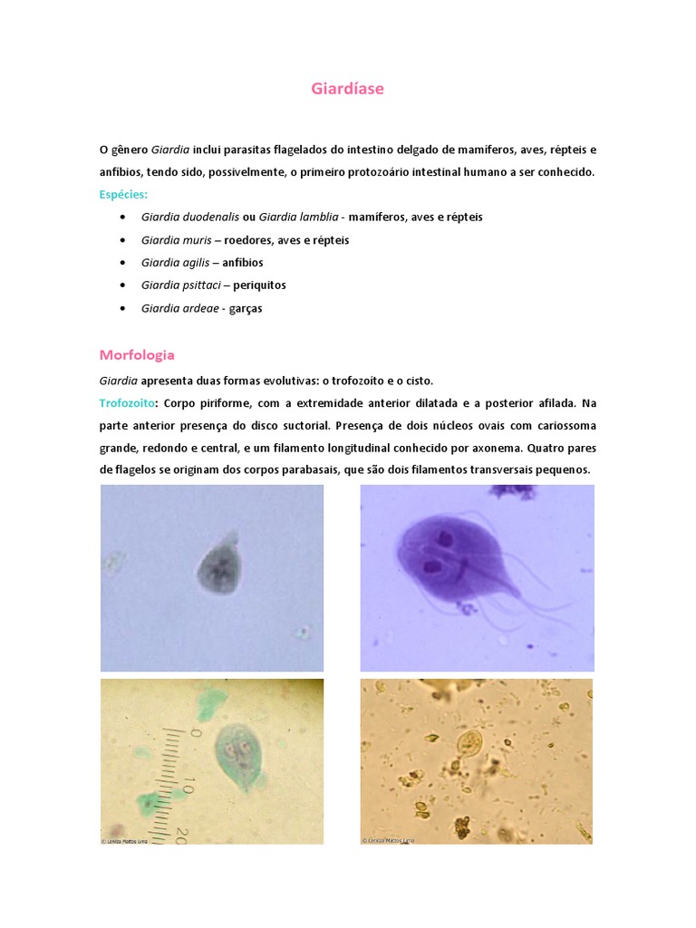 Giardíase | Microbiologia | Imunologia