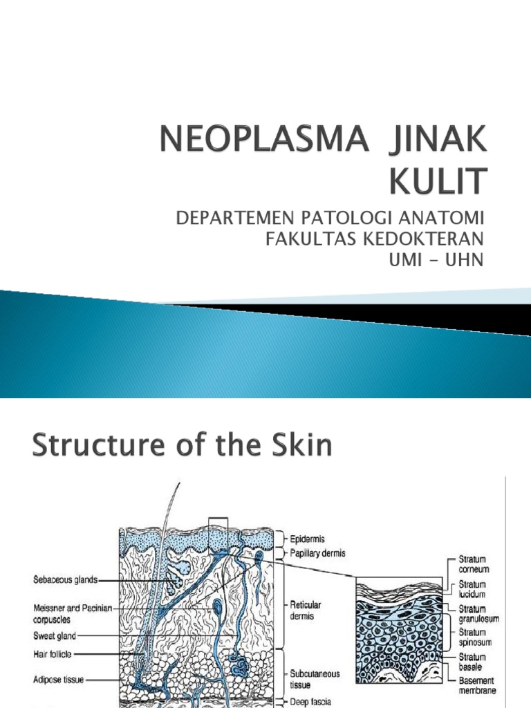 Neoplasma Jinak Kulit | PDF | Cutaneous Conditions | Neoplasms