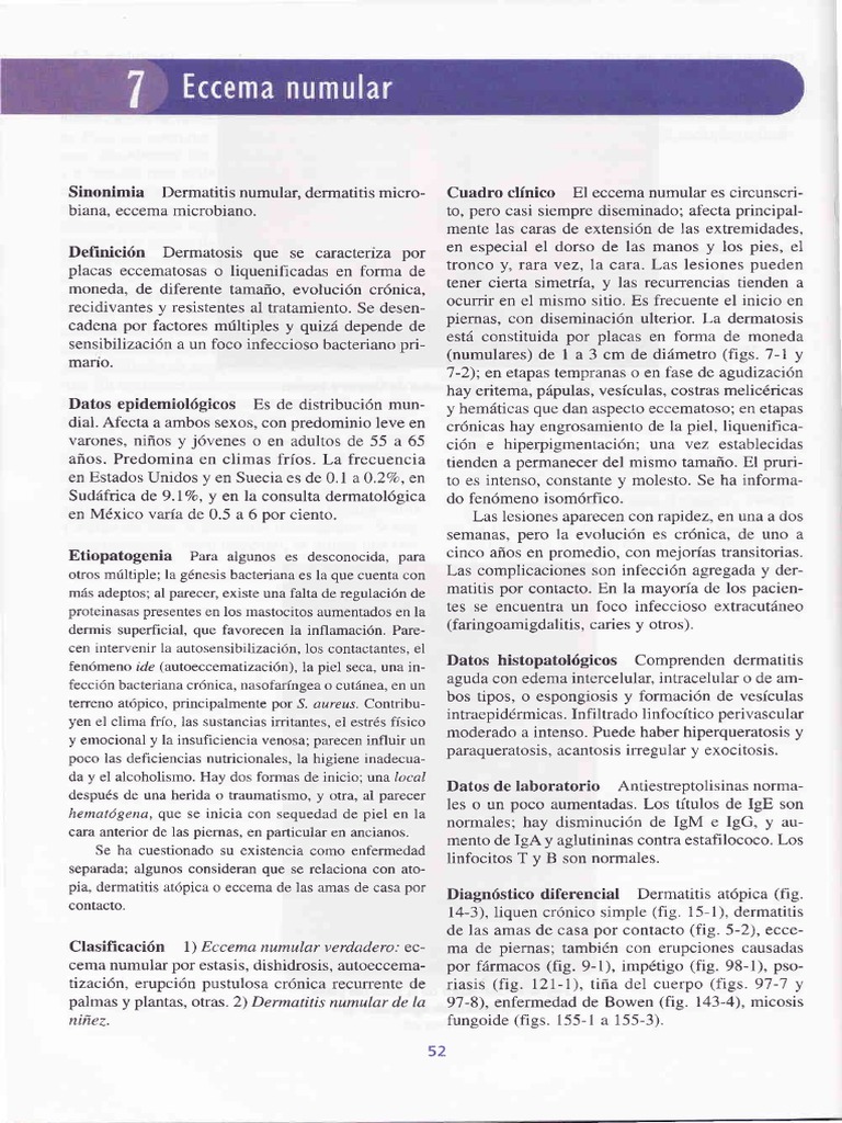 Eccema Numular | PDF | Especialidades Medicas | Medicina CLINICA