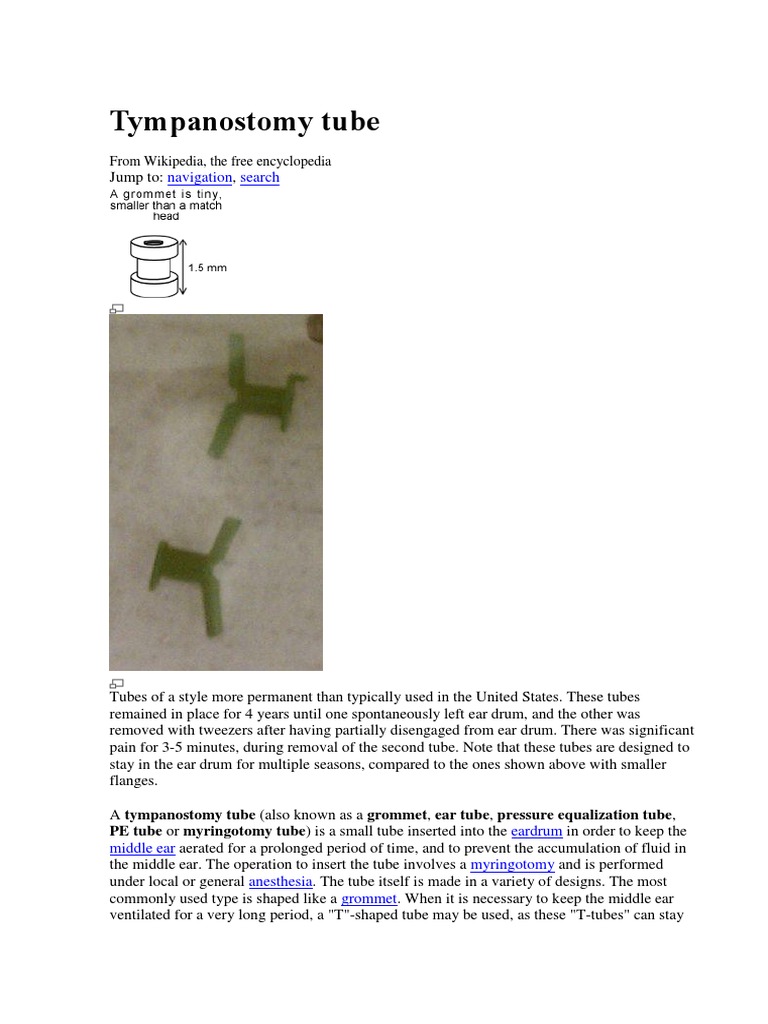 Tympanostomy Tube: Navigation Search | PDF | Hearing | Clinical Medicine
