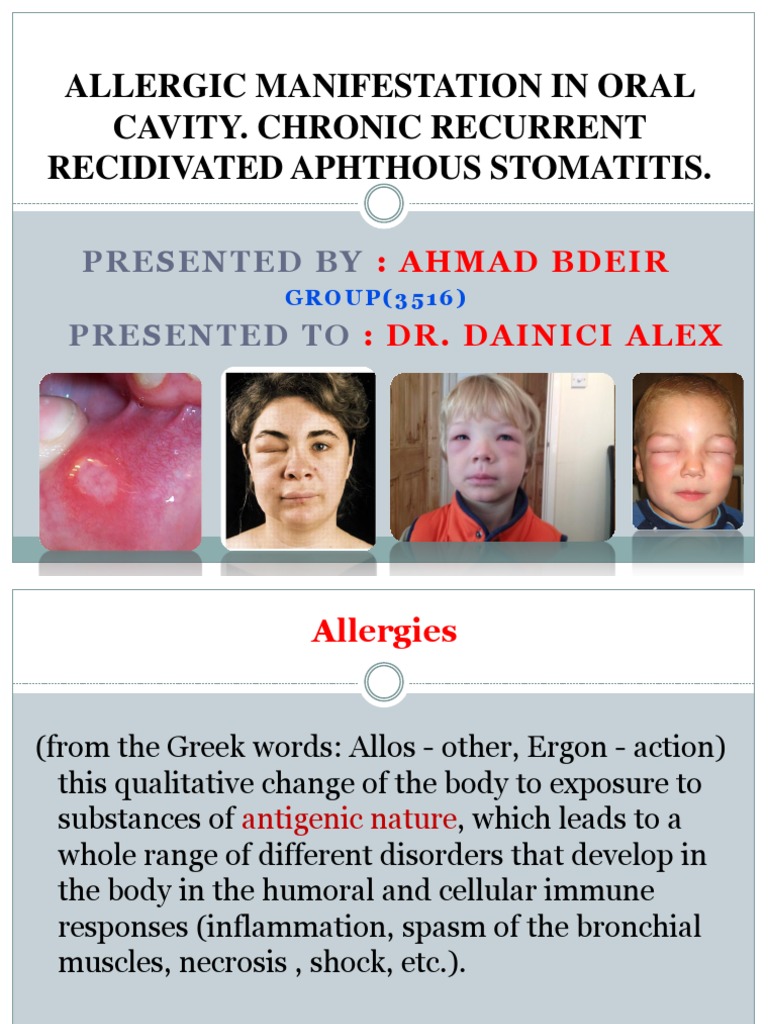 Allergic Manifestation in Oral Cavity. Exudative Polymorphic Erythema ...
