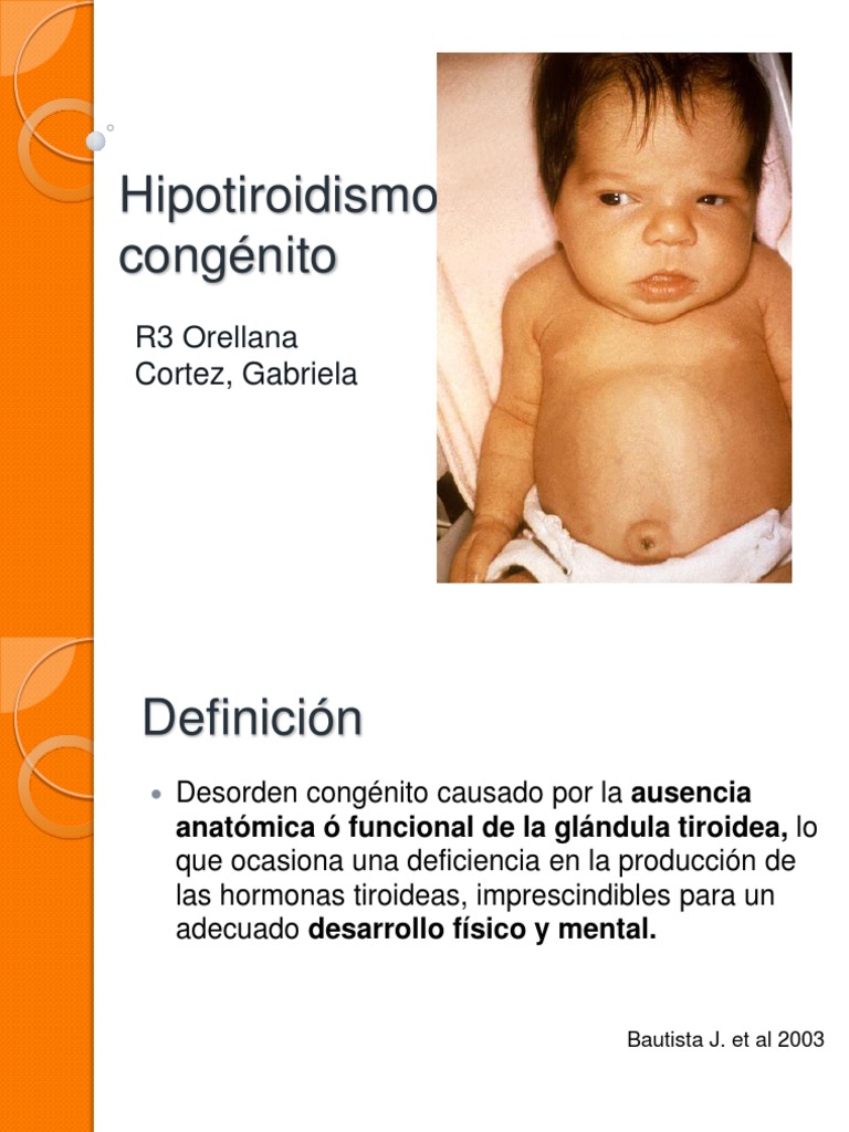 Hipotiroidismo Congénito