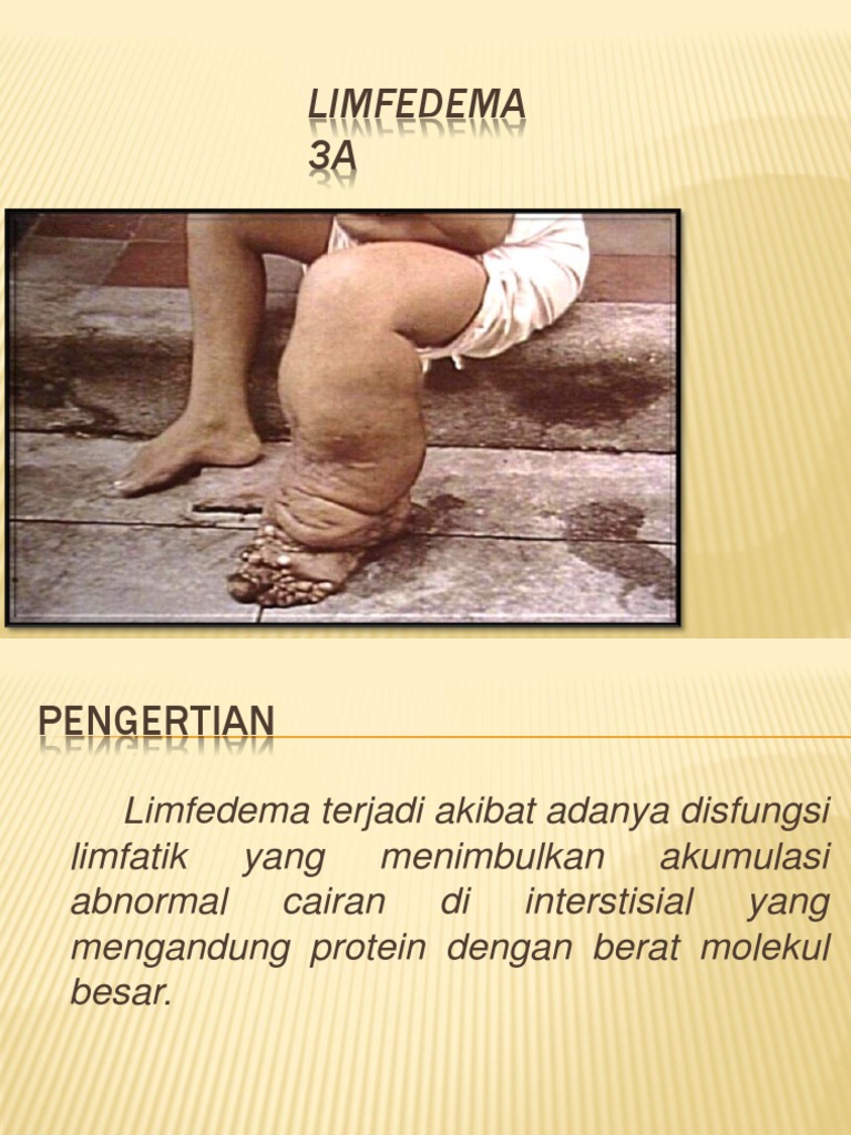 Limfedema | PDF