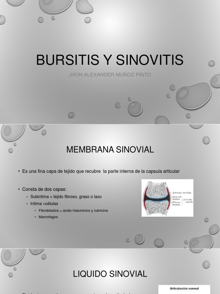 Bursitis y Sinovitis | PDF | Hombro | Sistema musculoesquelético