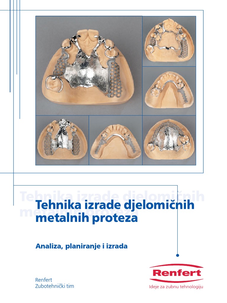 Referentni Tim Skeletirana Proteza | PDF