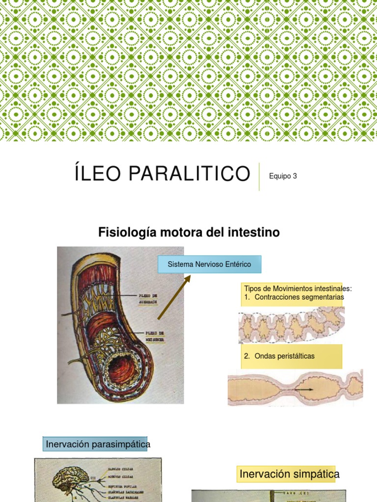 Íleo Paralitico | PDF