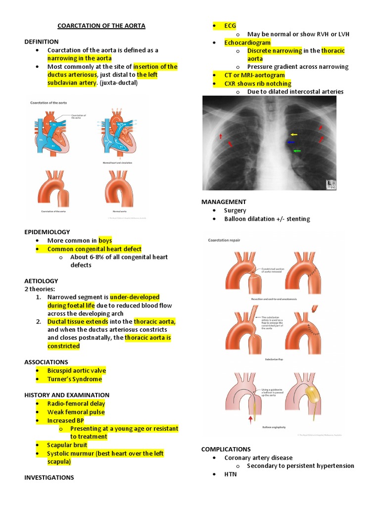 Coarctation of The Aorta | PDF