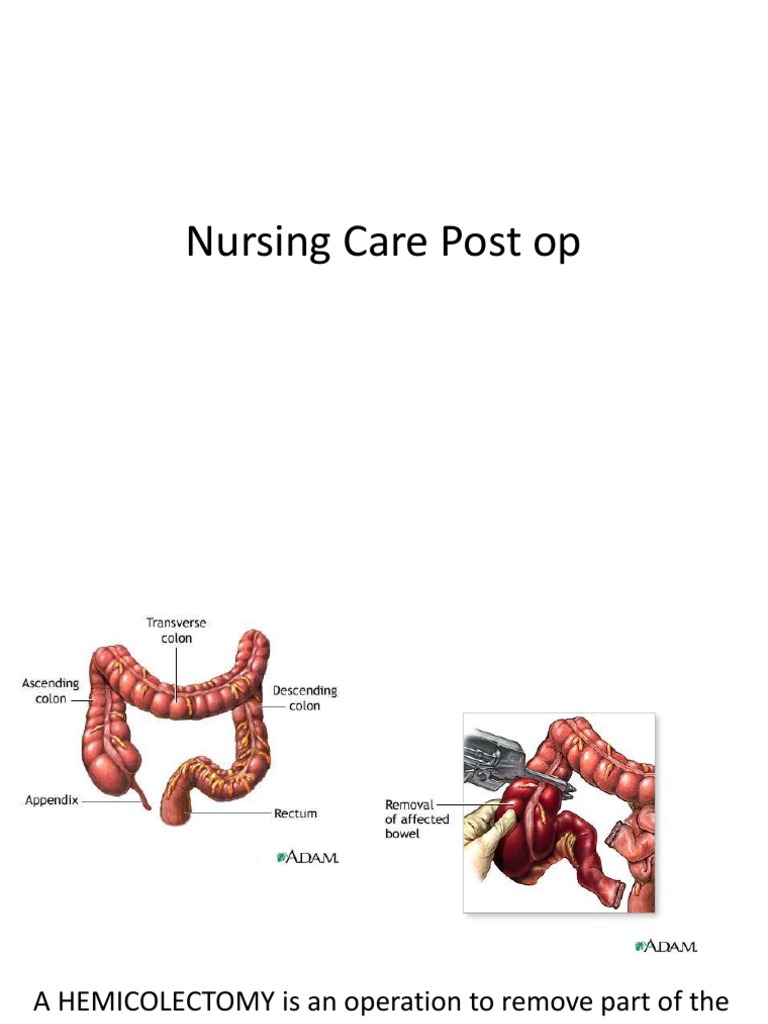 Nursing Care Post Op | PDF | Colorectal Cancer | Surgery