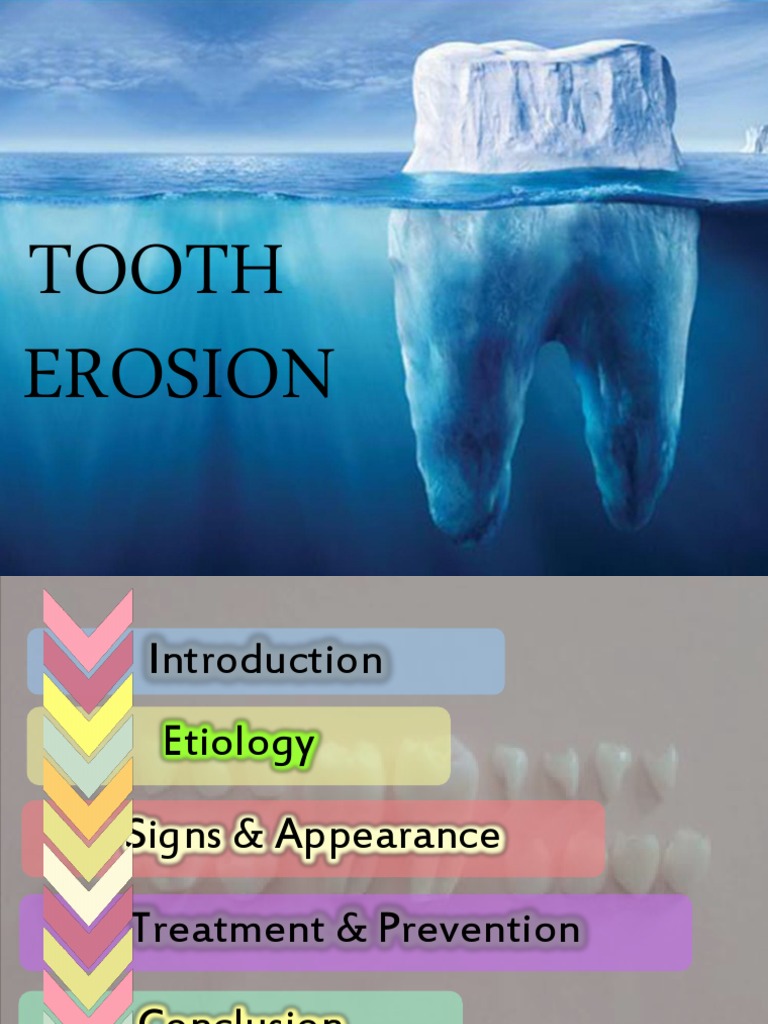 Tooth Erosion | PDF | Human Tooth | Tooth Enamel