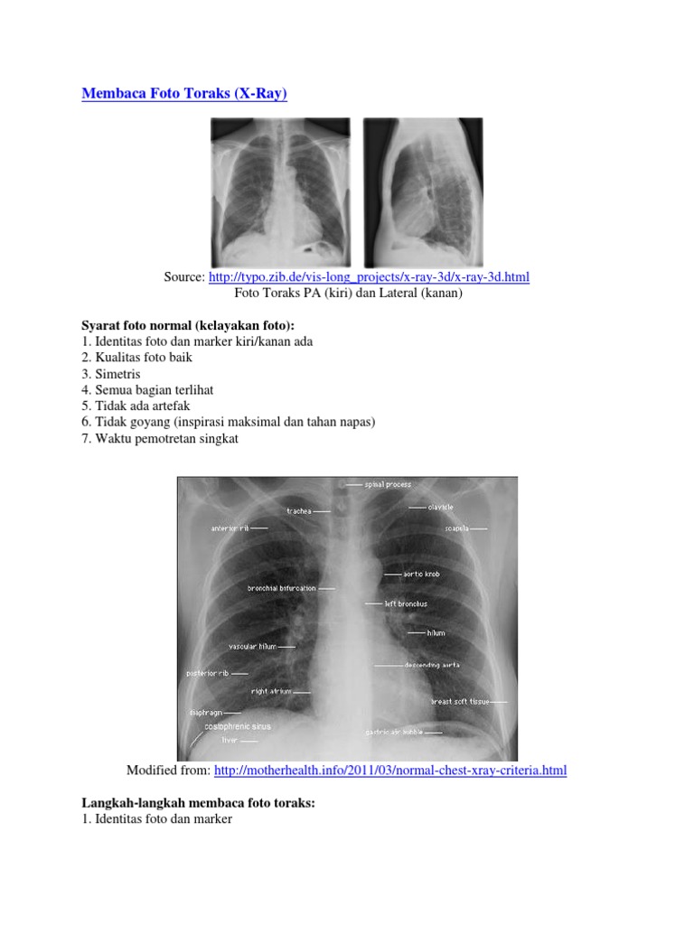 Membaca Foto Toraks | PDF