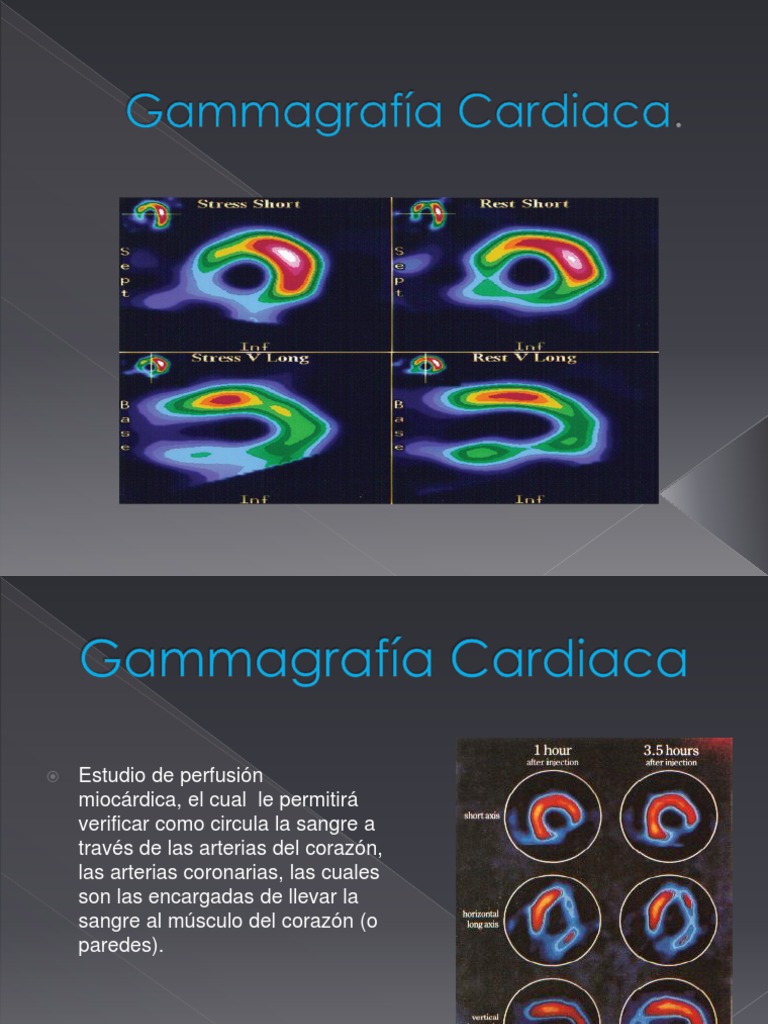 Gammagrafía tiroidea POWER POINT | Medicina Nuclear | Ultrasonido