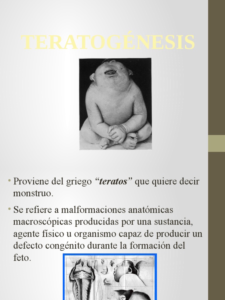 TERATOGÉNESIS | PDF