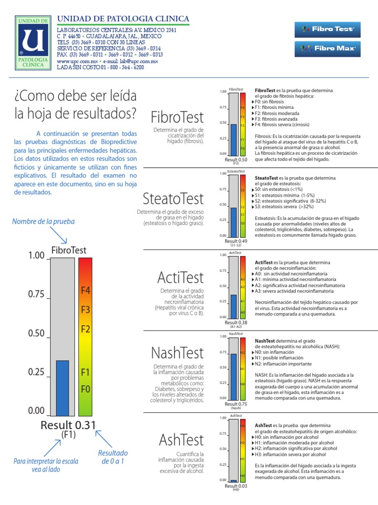 Interpretacion Fibromax | PDF | Cirrosis | Rtt