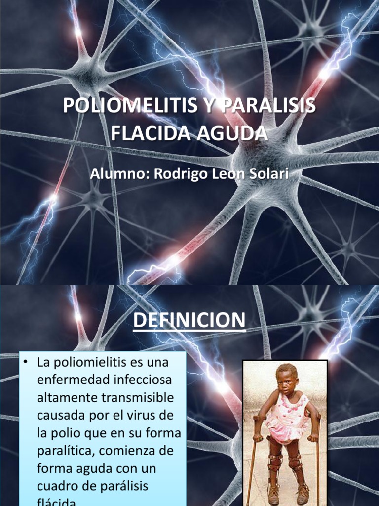 Poliomelitis y Paralisis Flacida Aguda | PDF | Poliomielitis ...