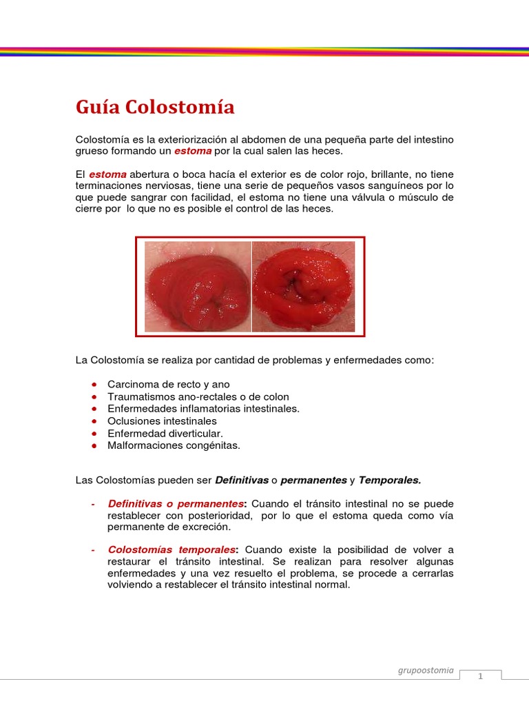 Guia Colostomia | Intestino grueso | Heces