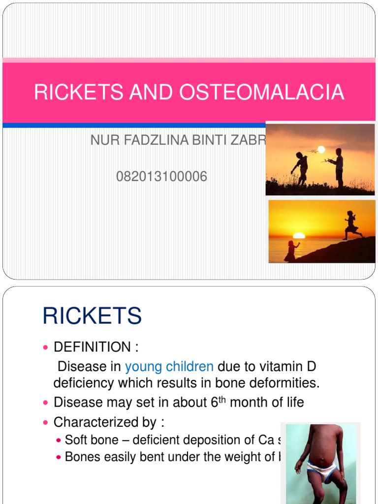 Rickets and Osteomalacia Overview | PDF | Bone | Vitamin D