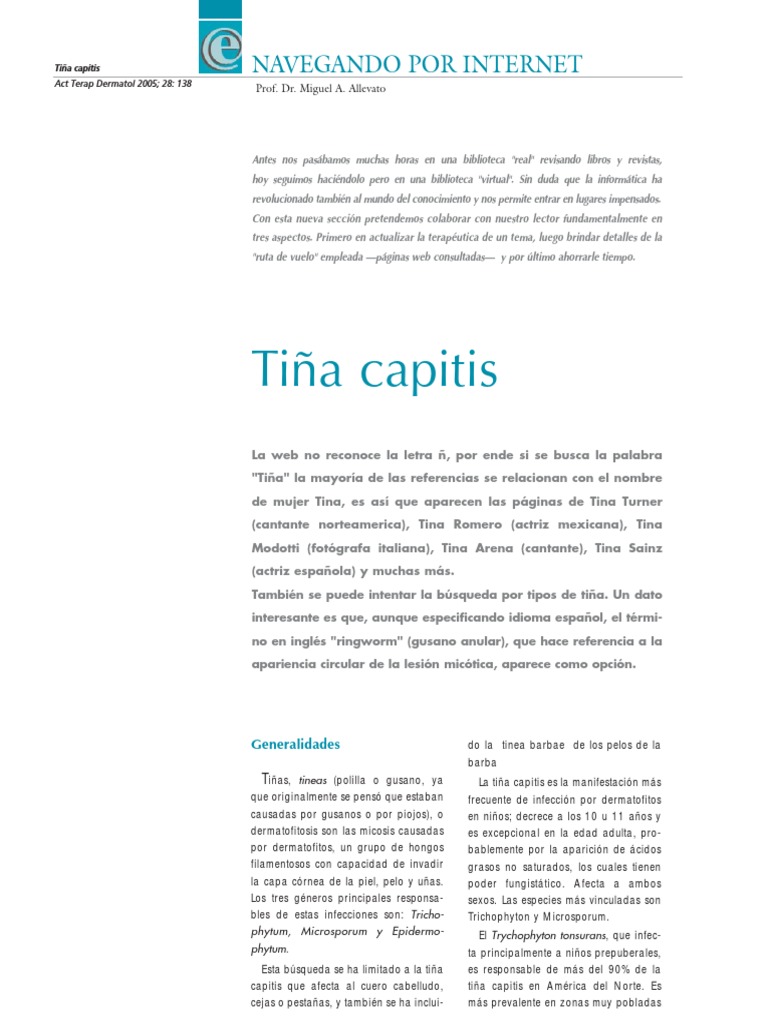 Tinea Capitis | PDF