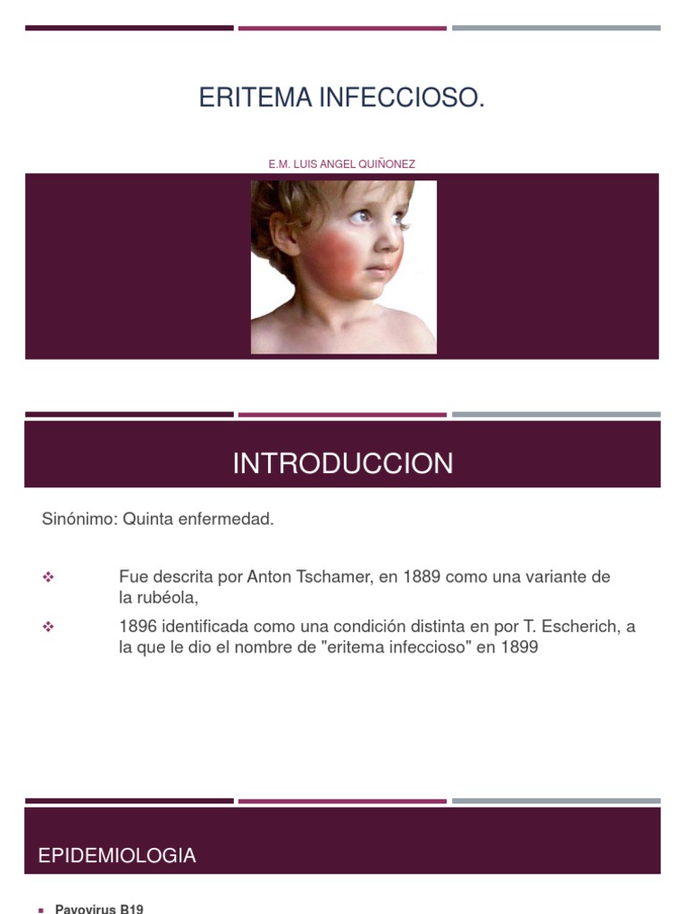 Eritema Infeccioso: Síntomas y Tratamiento | PDF | Virología | Rtt