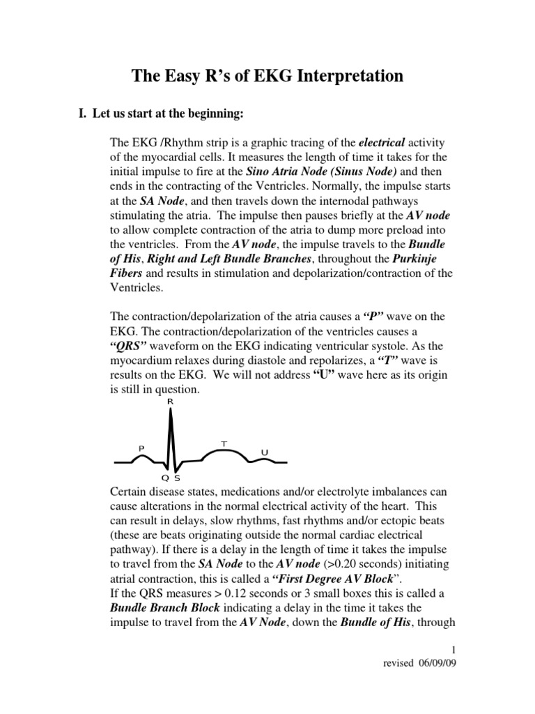 EKG Interpretation: The Easy R's Guide | PDF | Electrocardiography ...