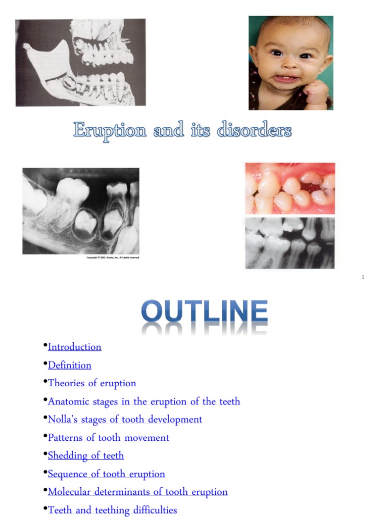 Tooth Eruption and Its Disorders - Pediatric Dentistry | PDF | Tooth ...