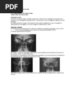 Proyecciones RX de Oído y Mastoides | PDF | Oído | Otología