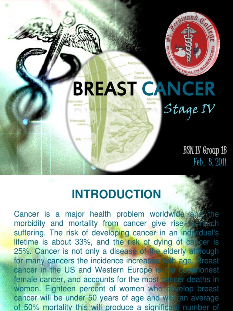 Breast Cancer Overview and Case Study | PDF | Radiation Therapy ...